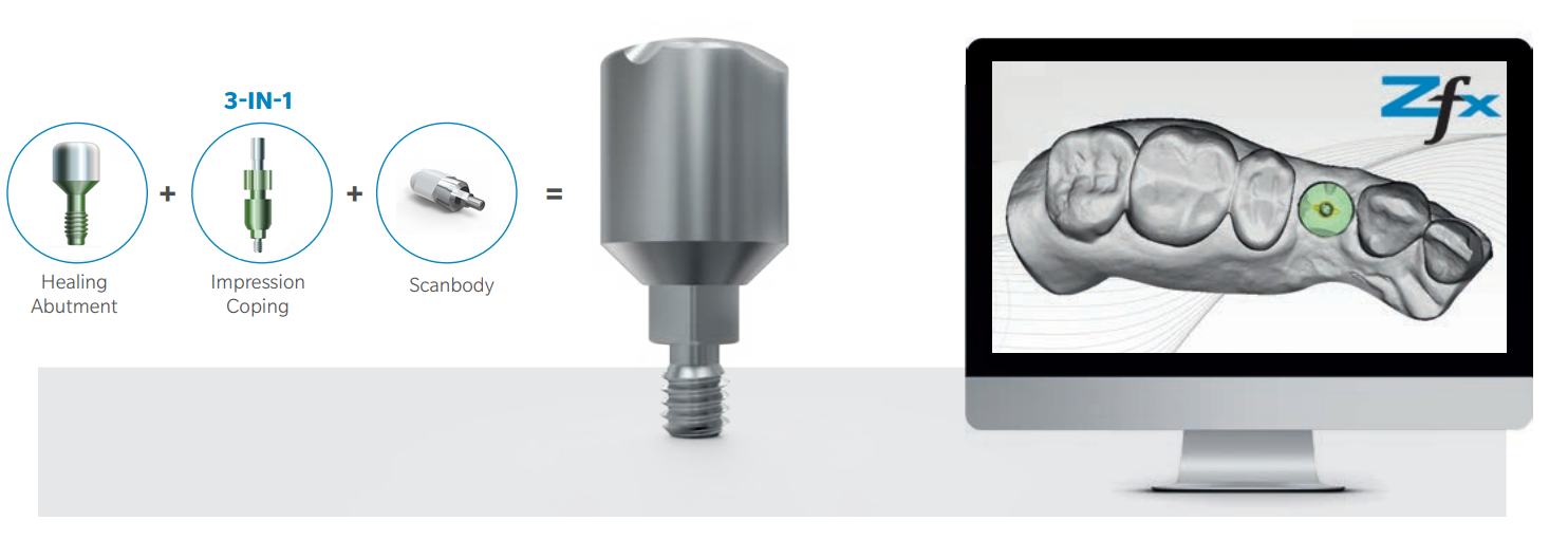 Encode® Impression System - Implacom BV